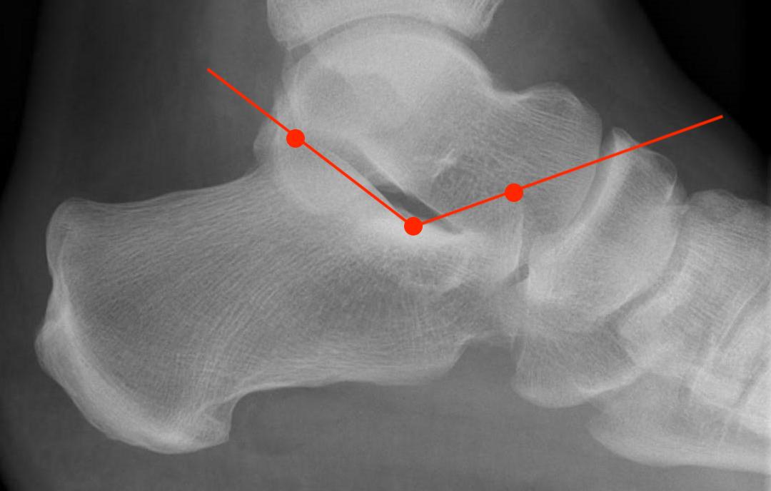 Background | The Bone School